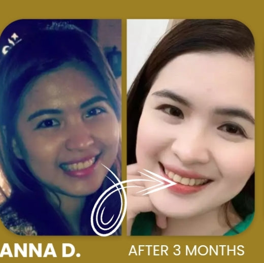 Ureshii Glutathione Complex Bundle – Ideal Beauty Deals